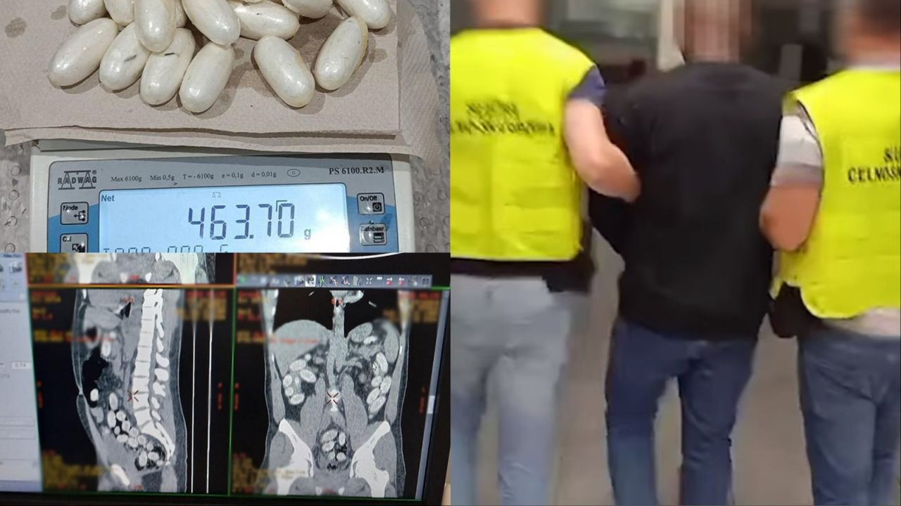 Poland seizes drug mule hiding cocaine inside his stomach